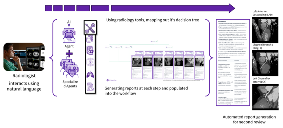 Reinventing radiology imaging workflows with agentic AI - GE HealthCare ...